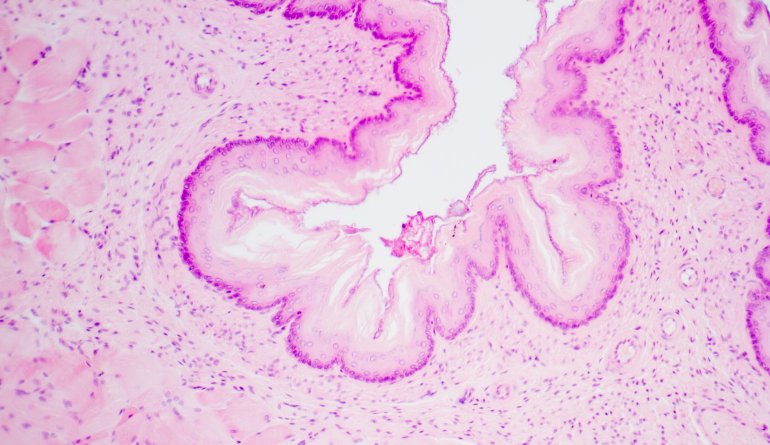 When the dust settles: maximizing image clarity for microscopy ...